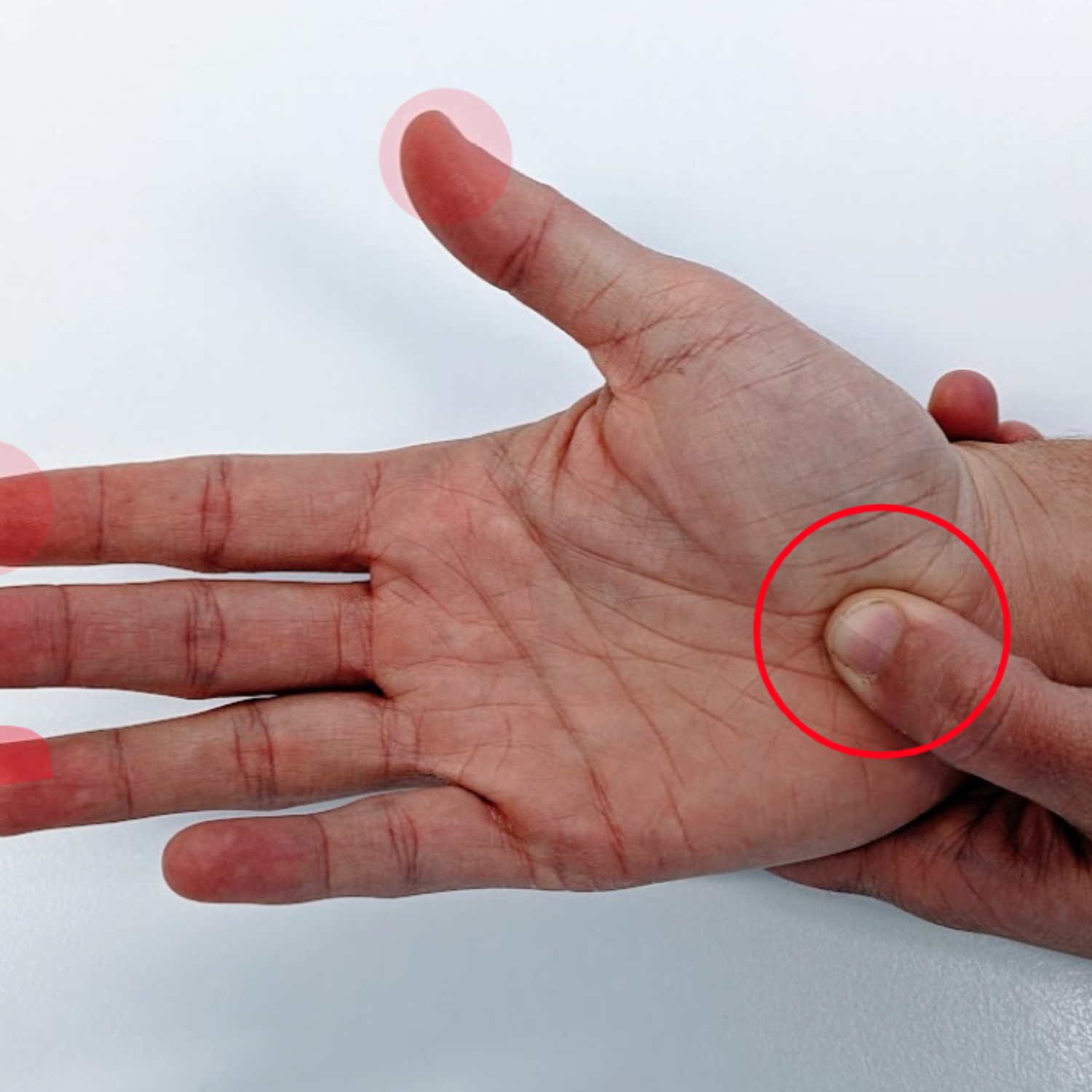 Hand & pols | Orthoclinic - Orthopedie Brugge